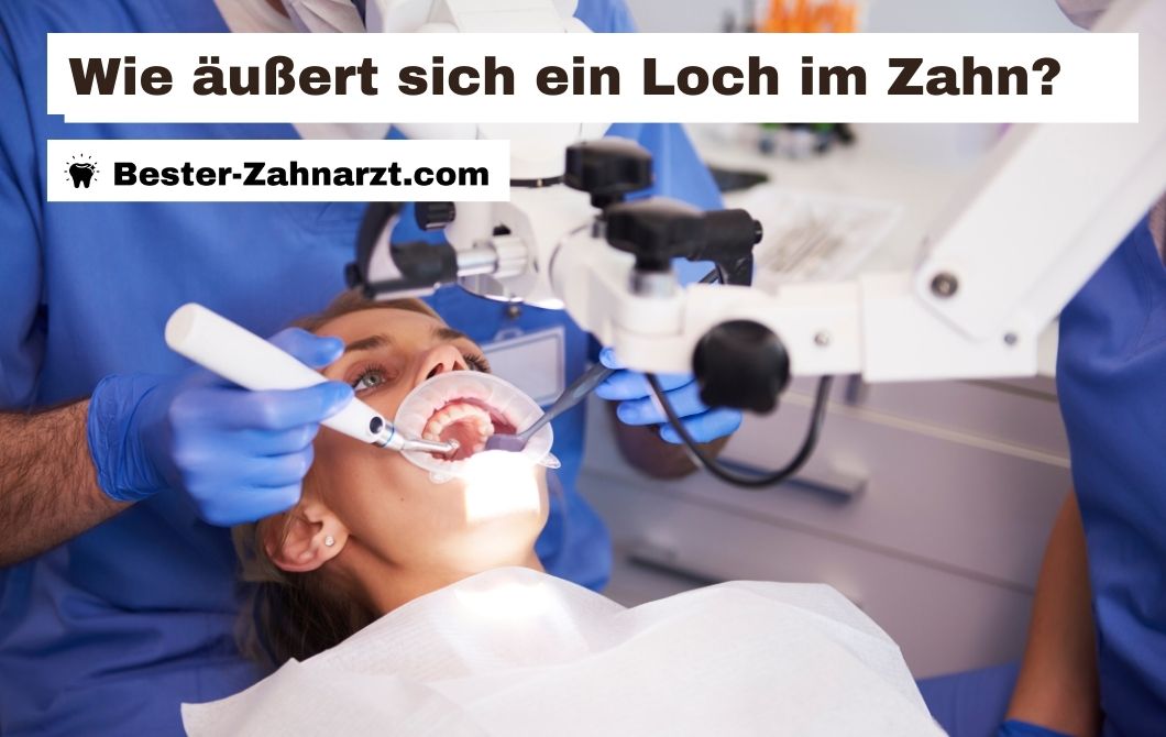 Loch im Zahn? Jetzt umbedingt handeln - 5 wichtige Tipps!